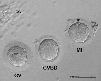 Oocyte Maturation for IVF - Art Compass IO