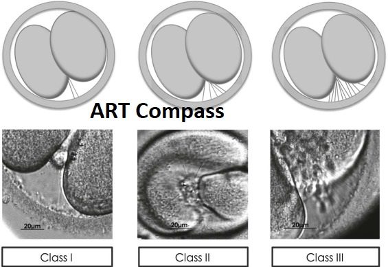 Cleavage Stage Embryos: Day 3 Embryologist Perspective